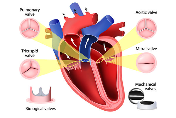Leuven’s onderzoek ontrafelt hoe ziekenhuisbacterie hartklep infecteert ...